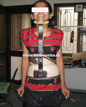 ORTHOTICS PROSTHETICS RESEARCH